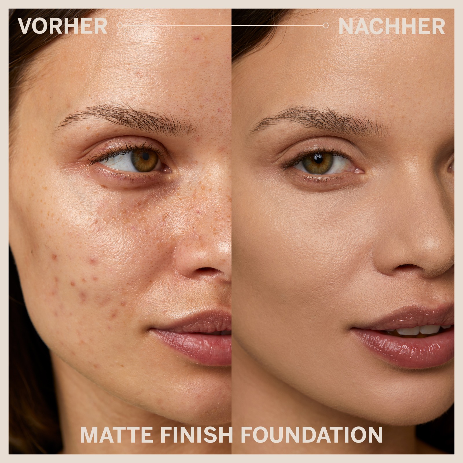 Unser Foundation 1x1 für Dein perfektes Sommer Make-Up │von BABOR